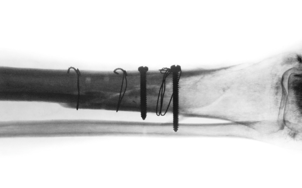 Procured Health raises $10 million » TechTaffy