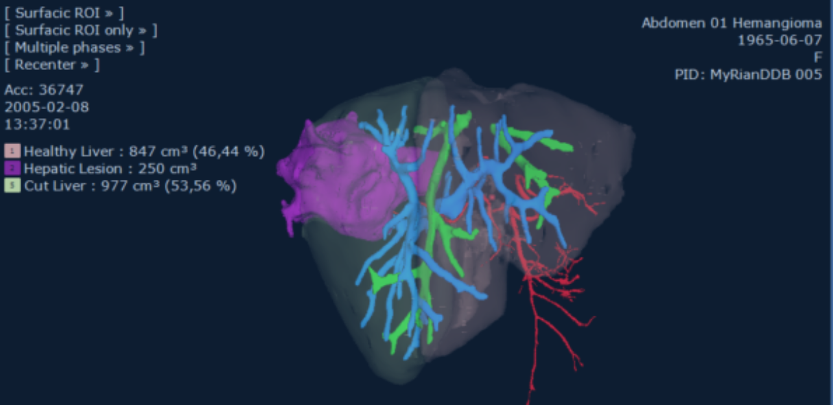 Sectra signs imaging software and analytics contract with Stanford ...
